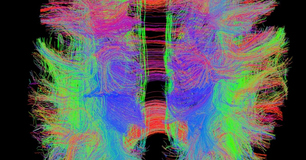 Medical Research Foundation | Decoding brain disease in lupus